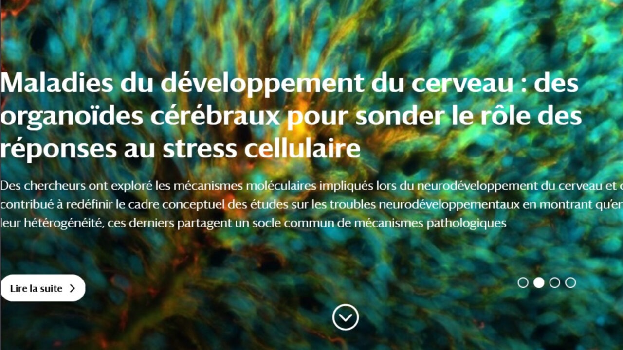 L’université Paris Cité apporte un éclairage sur notre étude récente ...